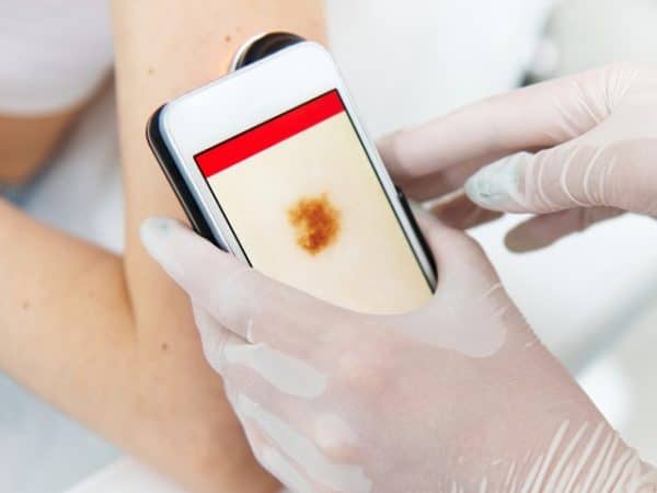 What to Expect During a Skin Biopsy - Harris Dermatology